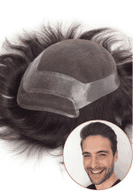 What Does 100 Strands of Hair Loss Look Like?