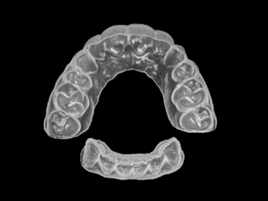 Advanced Solutions! A Closer Look at Dental Invisalign Advantages