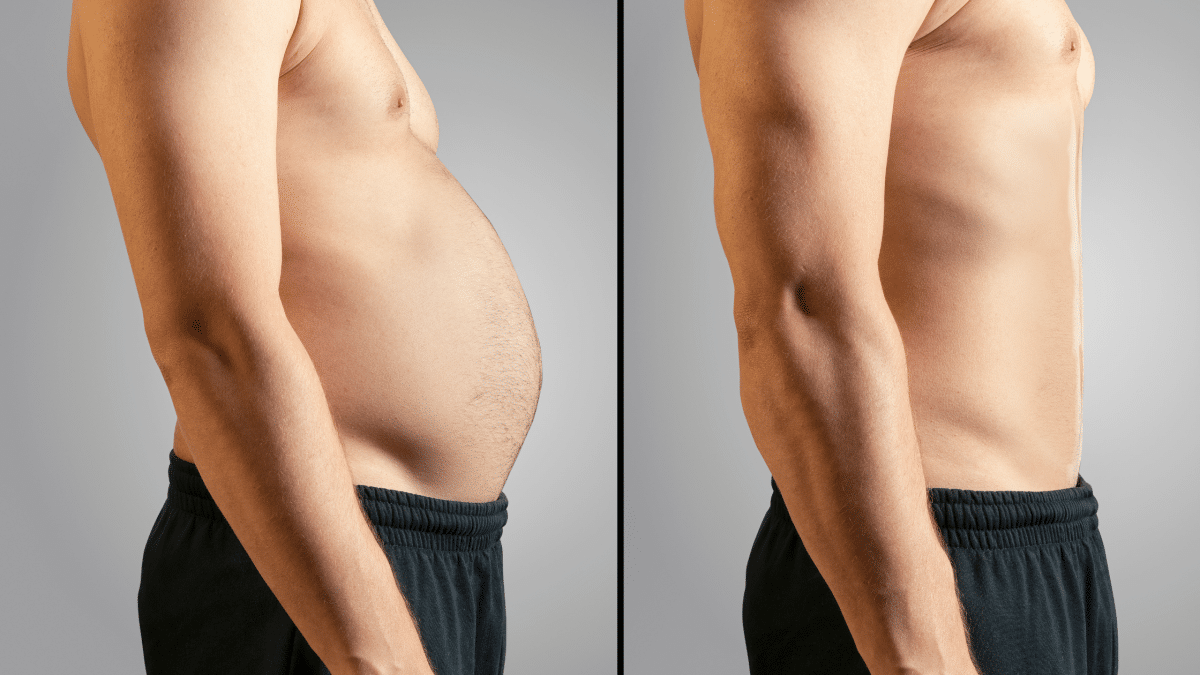Why More Men Are Choosing Thailand for Body Contouring Surgery